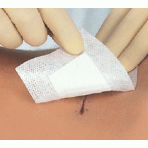 Cutiplast Steril Non Woven Adhesive Island Dresing 10Cm X 8Cm - Pad 6Cm ...